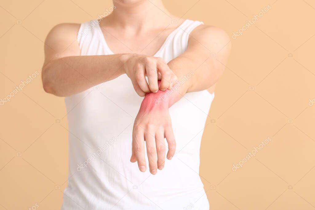 Mujer alérgica joven rascarse la piel contra el fondo de color 2024