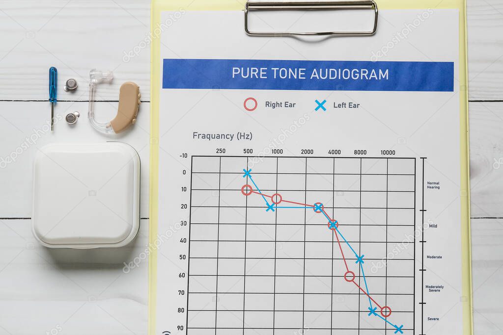 Audiograma con audífono y accesorios sobre fondo blanco de madera 2024
