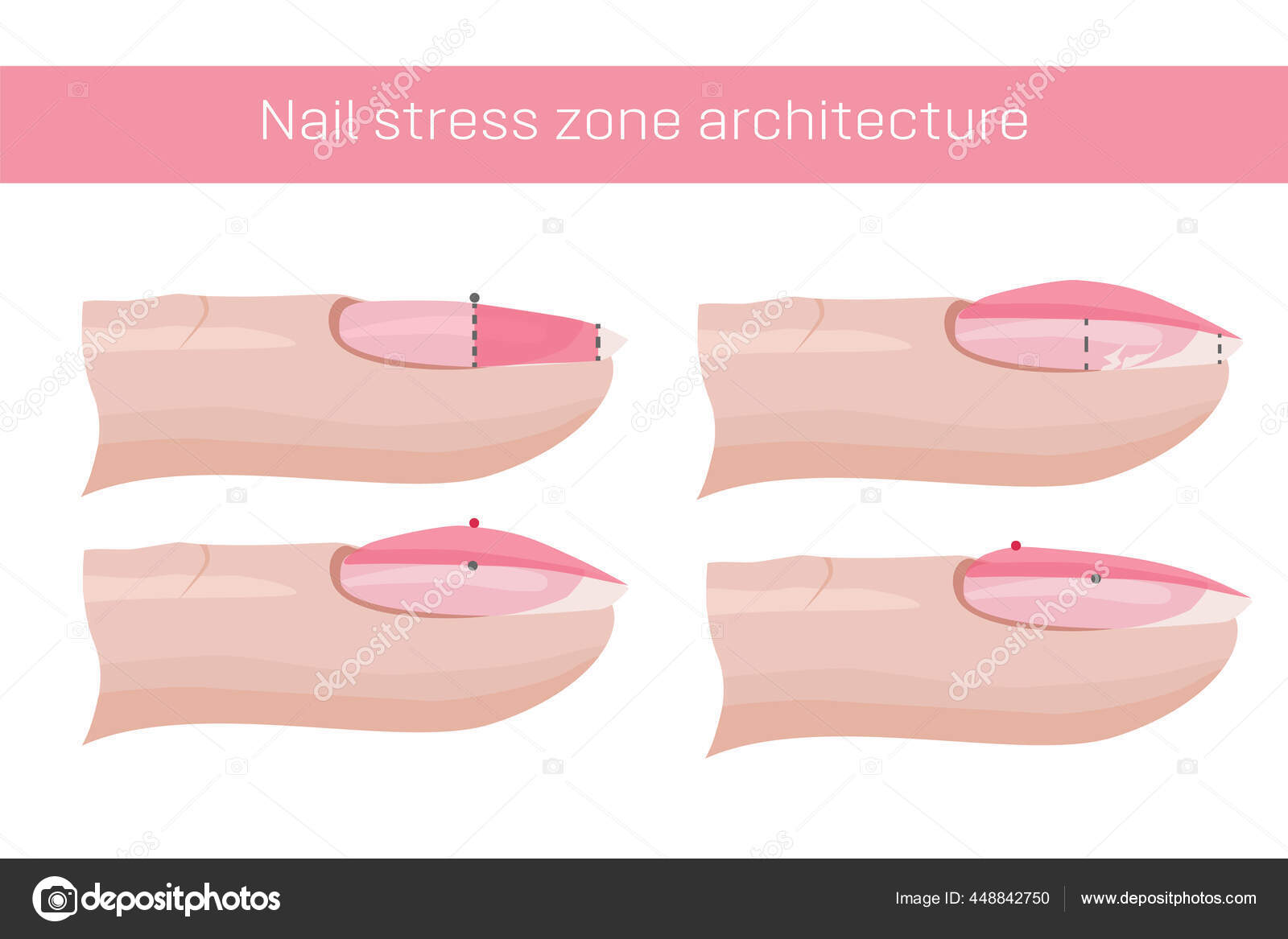 Nail Care Architecture Nail Stress Zone Recovery Illustration Manual ...