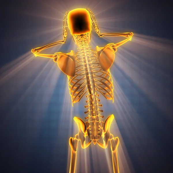 Human bones radiography scan image - Stock Image - Everypixel