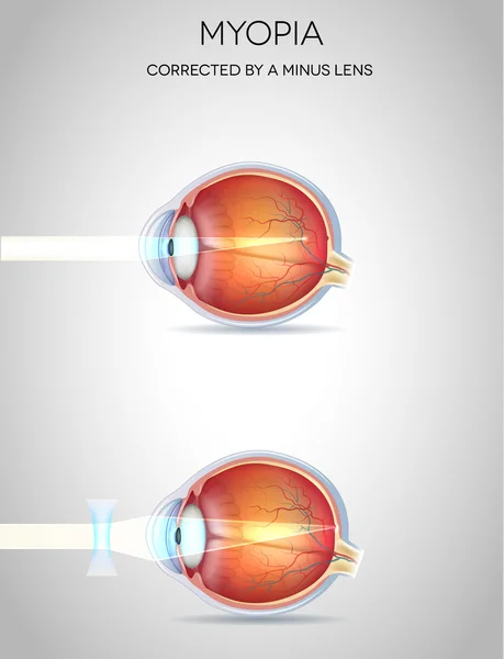 3,373 Structure of eye Vector Images | Depositphotos