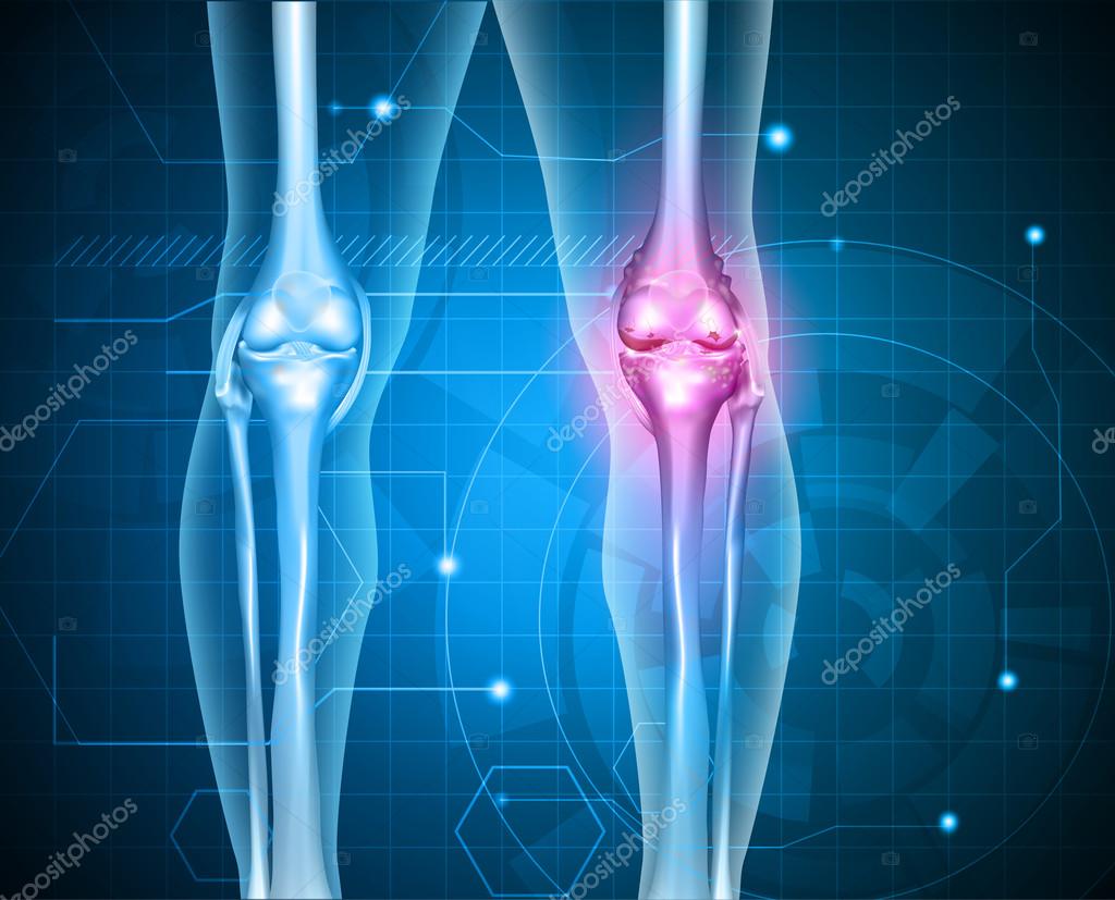 Knee pain abstract background Stock Vector by ©megija 71608833
