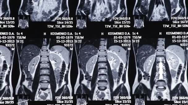 X-rays are a type of electromagnetic radiation, just like visible light ...