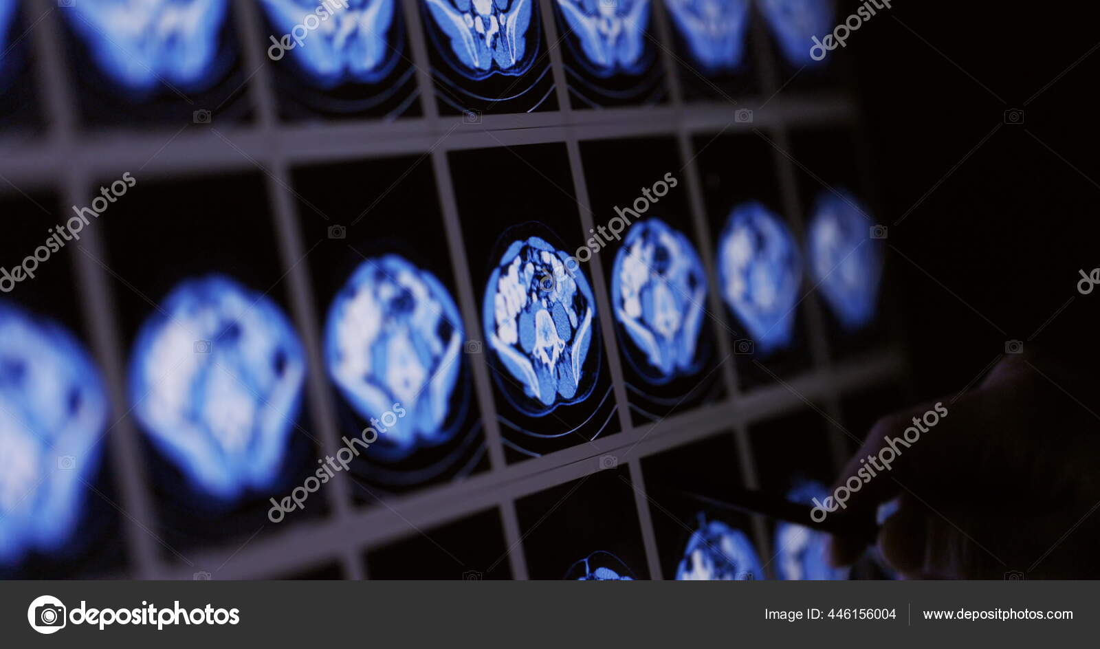 Hand Pointing Out Specific Picture Scan Closeup Footage — Stock Photo ...