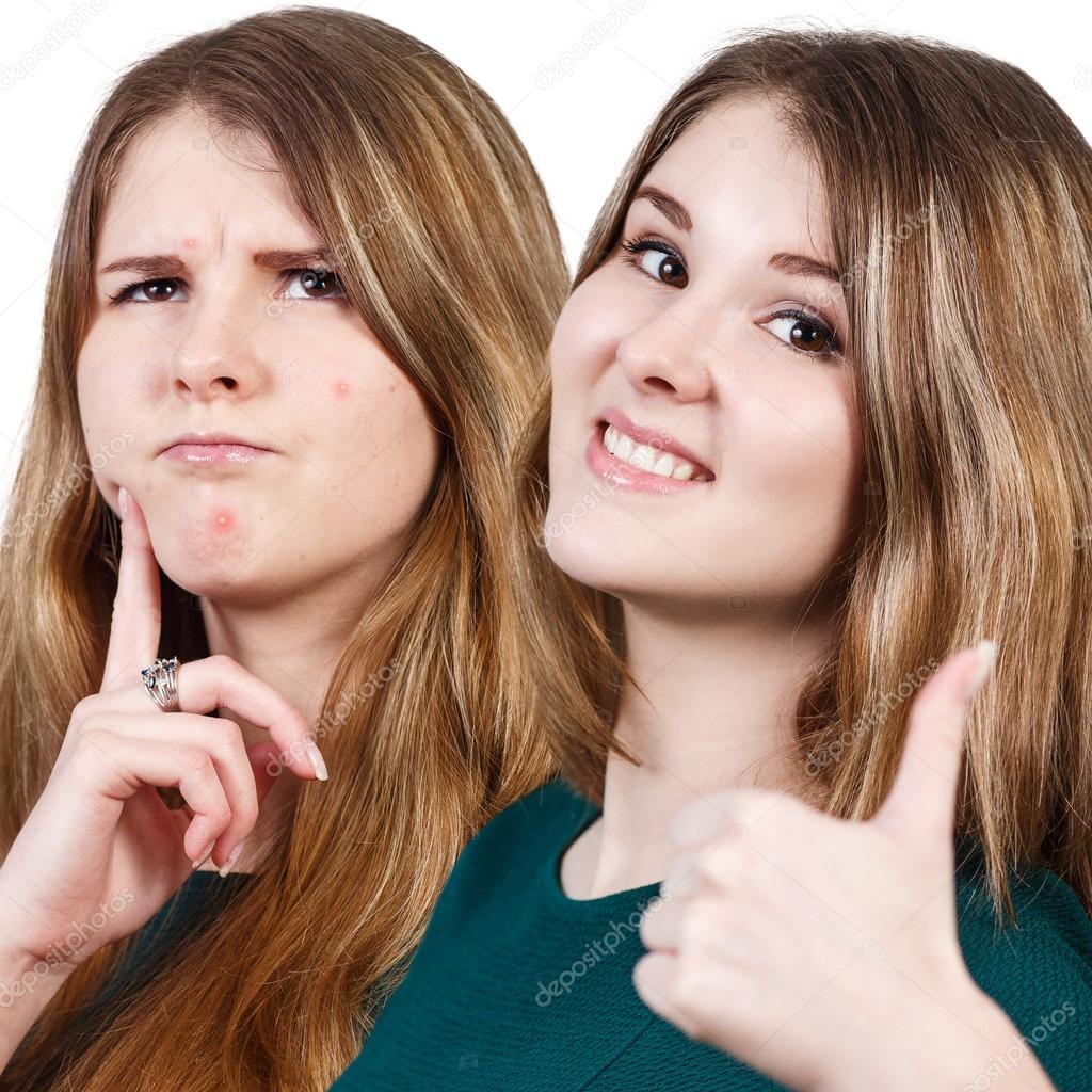 Woman with problem skin on her face — Stock Photo © kotin #108326012