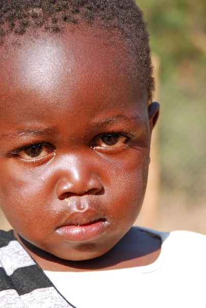 African children suffering from AIDS followed by the non-profit – Stock ...