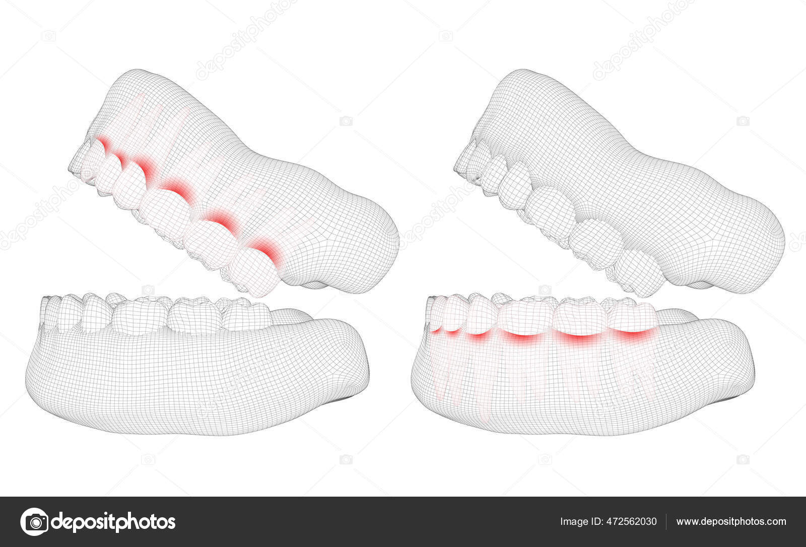 Human Jaw Vector Layout Medicine Health Pain Teeth Stock Vector by ...
