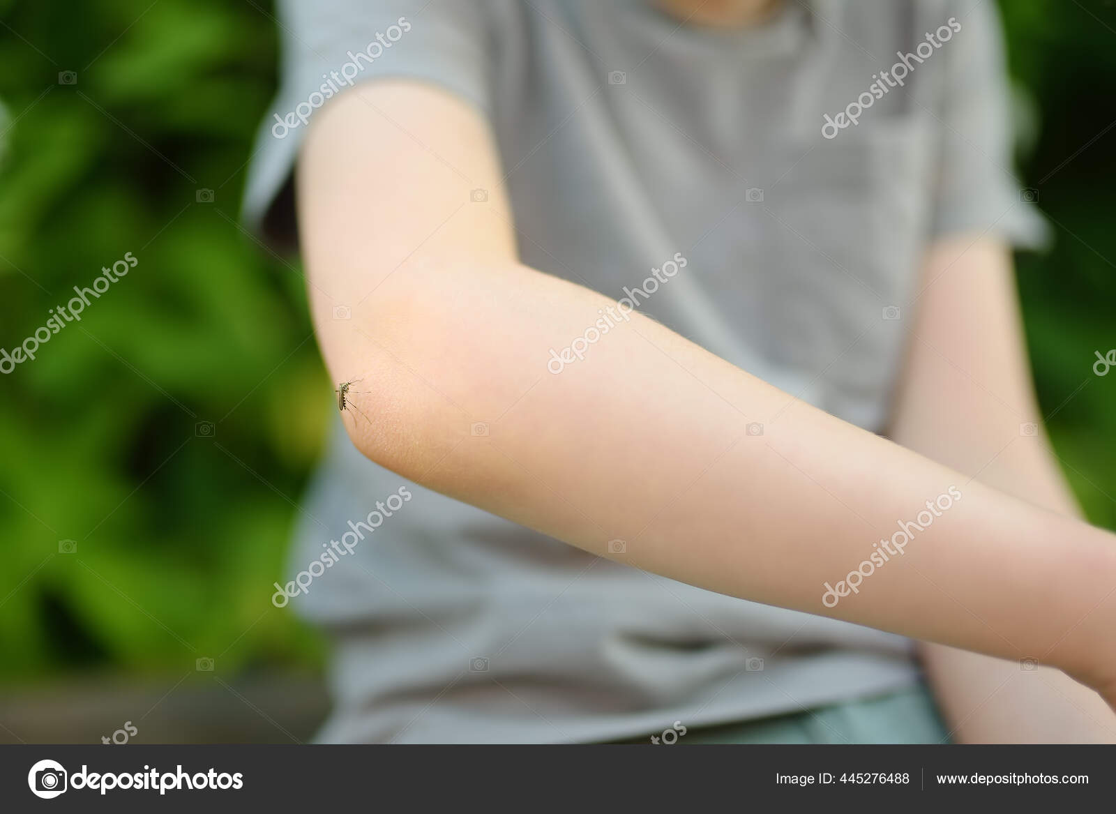 Mosquito Sitting Hand Child Gnat Sucking Blood Danger Bite Insect Stock ...