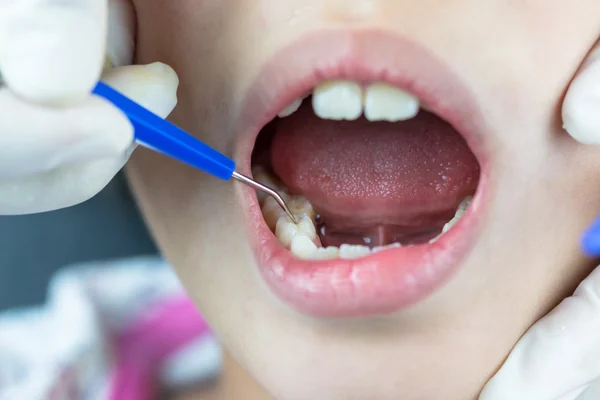 Close up teeth Images - Search Images on Everypixel