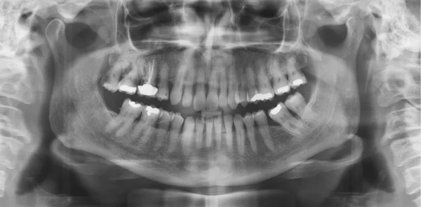 Dental panoramic radiography - Stock Image - Everypixel