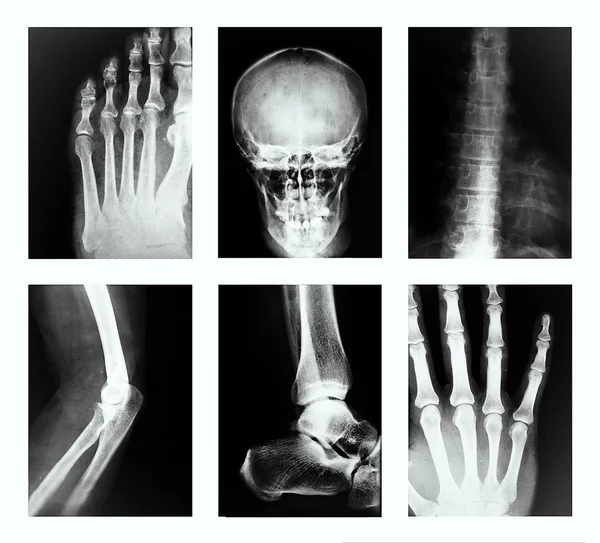 Collage of many X-rays Stock Photo by ©belchonock 102117658