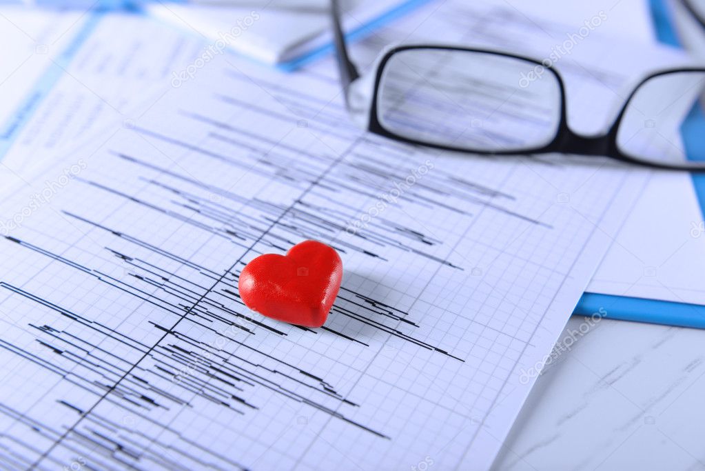 Cardiogram chart with glasses and small red heart — Stock Photo ...