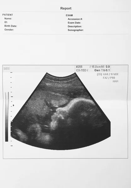 Ultrasound baby scan — Stock Photo © belchonock #112239526