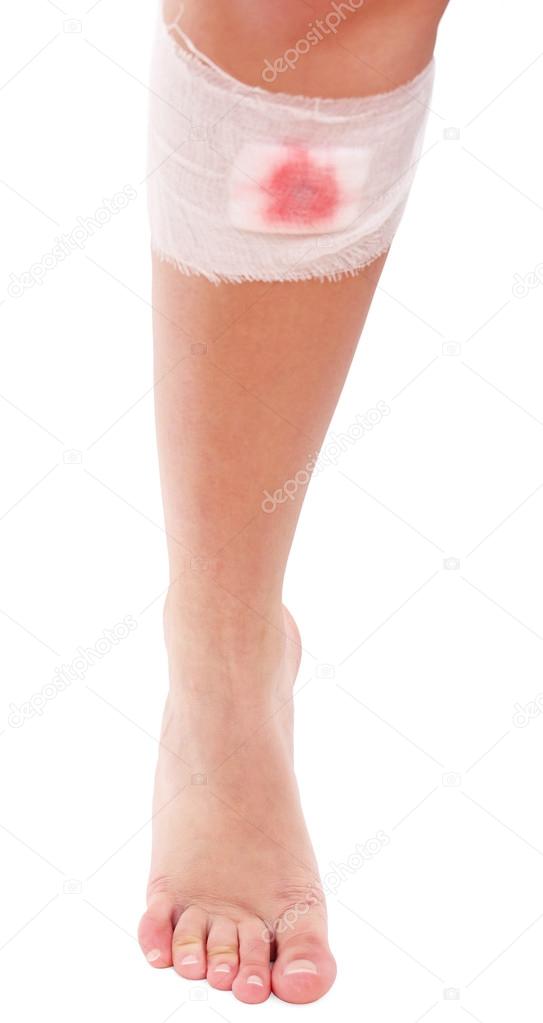 Wounded leg with bandage — Stock Photo © belchonock #65018551
