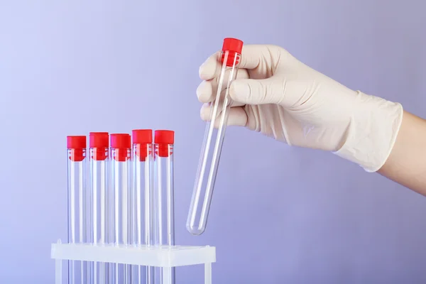 Test tube labeled Tuberculosis(TB) in hand on red background Stock ...