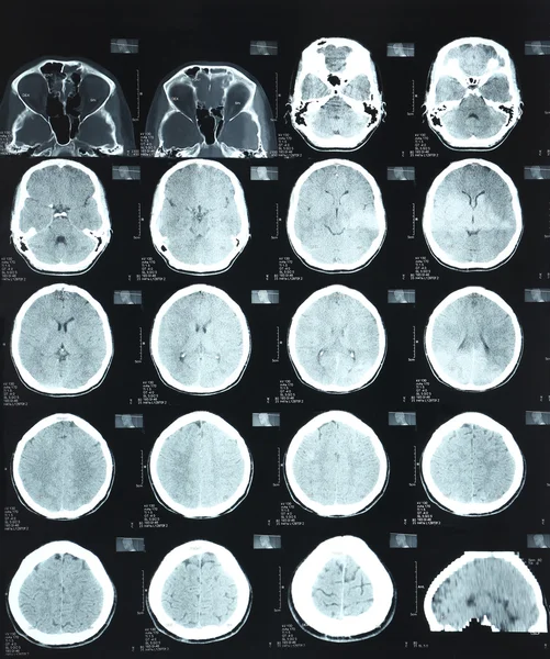 X-ray scanner of internal organs isolated on white Stock Photo by ...