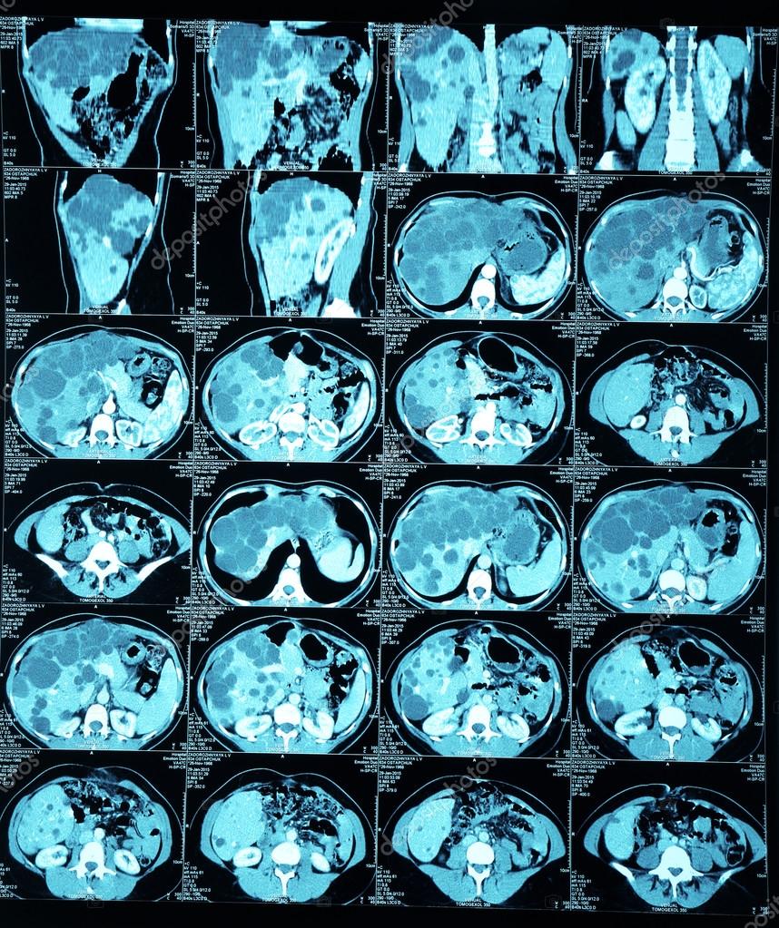 X-ray scanner of internal organs isolated on white Stock Photo by ...
