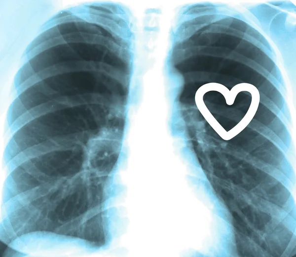 Human x ray with heart Stock Photos, Royalty Free Human x ray with ...