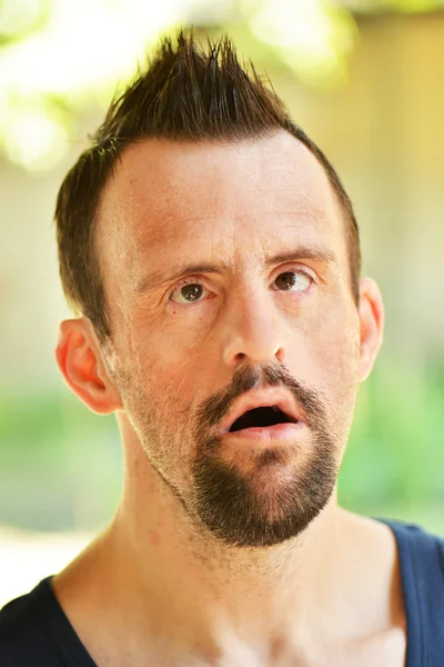 Hombre con síndrome de Down: fotografía de stock © muro #9172665 ...