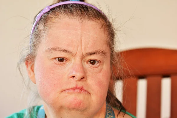 Woman with down syndrome Stock Photo by ©muro 45336343