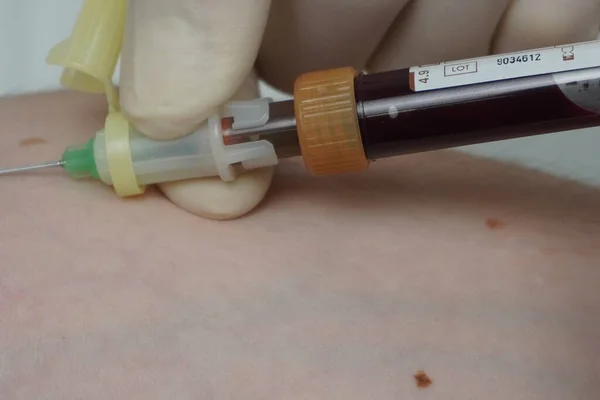 Injections into the vein Stock Photos, Royalty Free Injections into the ...