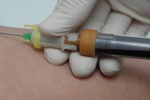 Arm injection Stock Photos, Royalty Free Arm injection Images ...