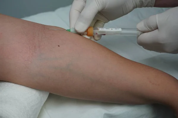 Pressopuncture Stock Photos, Royalty Free Pressopuncture Images ...