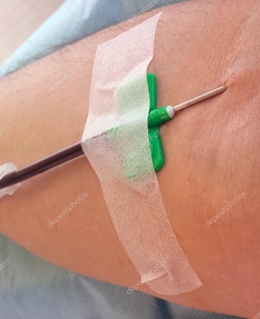Plasma Donation Needle