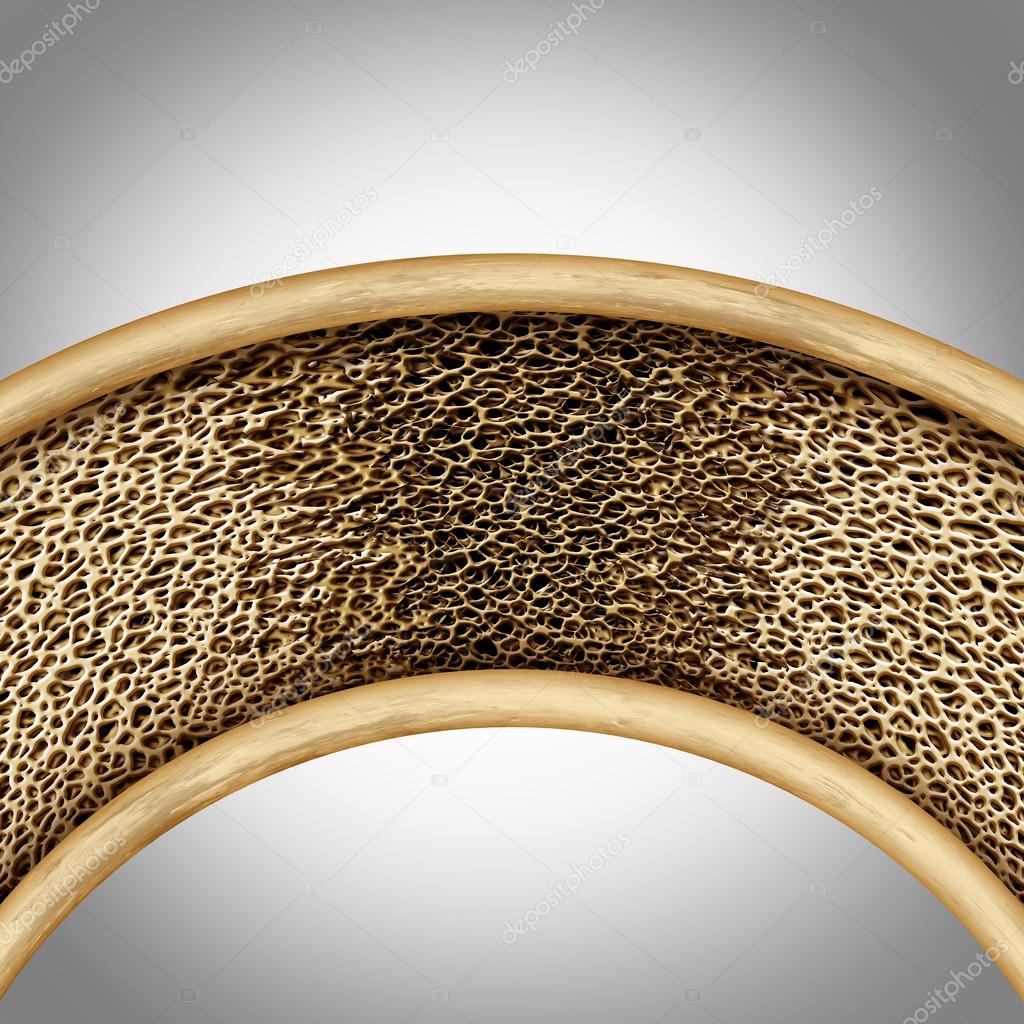 Bone Disease Concept Stock Photo by ©lightsource 96176670