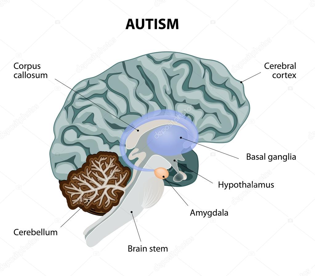 Autism Stock Vector by ©edesignua 60950687 Autism Stock Vector by ©edesignua 60950687