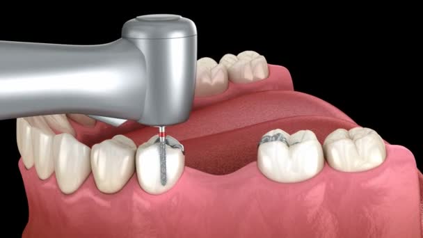 45,633 Dental Videos, Royalty-free Stock Dental Footage | Depositphotos