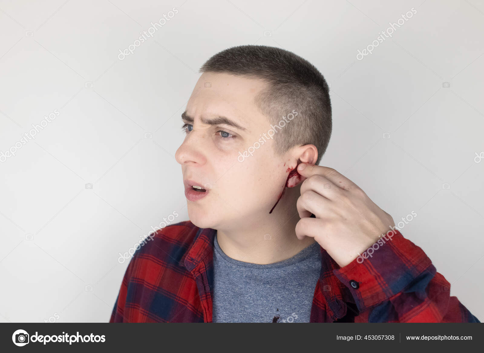 Man Whose Ear Bleeding Vascular Rupture Damage Tympanic Membrane Ear ...