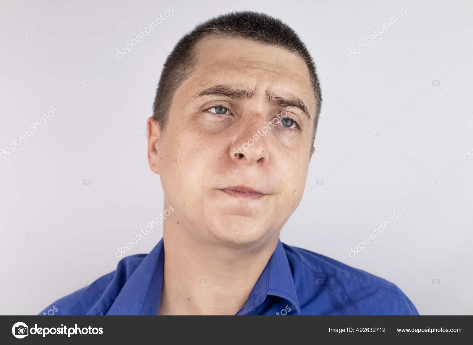 Man Sweating His Face Looking Camera Sweat Gland Problems Hyperhidrosis ...