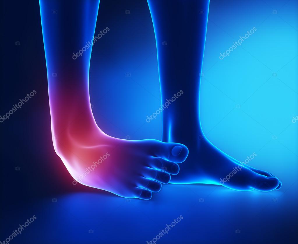 Sprained Ankle X Ray