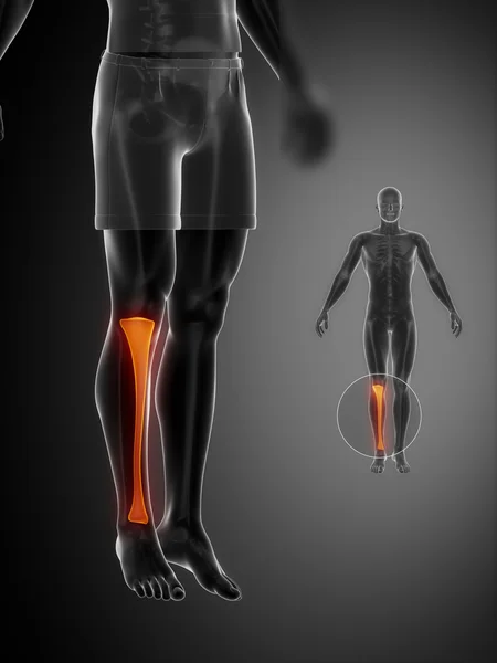 Tibia anatomy medical scan - Stock Image - Everypixel