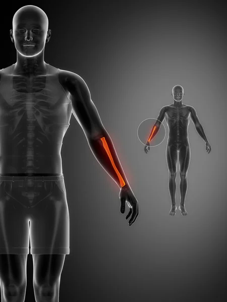 RADIUS x--ray bone scan - Stock Image - Everypixel