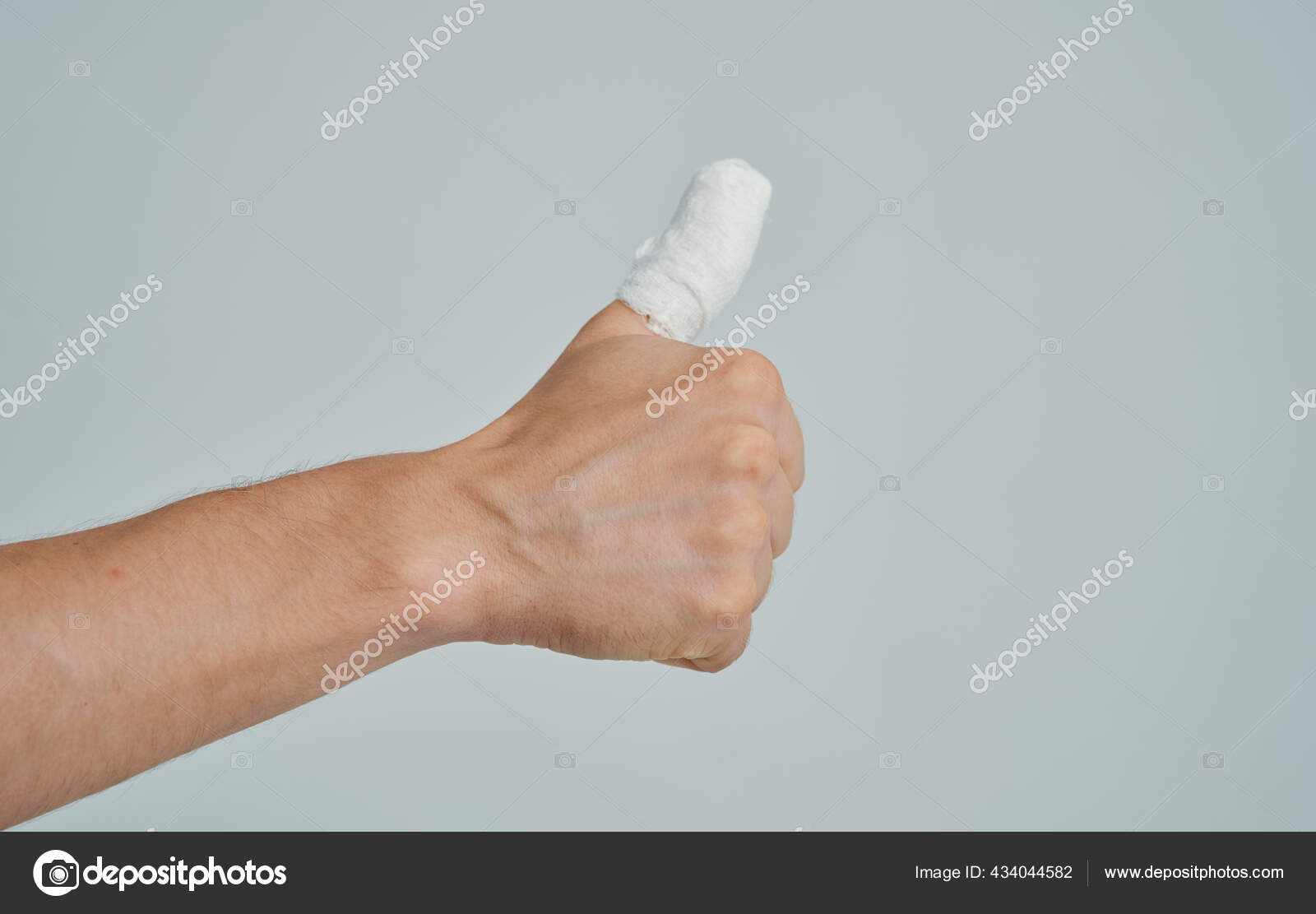 Man with broken thumb health problems medicine patient — Stock Photo ...