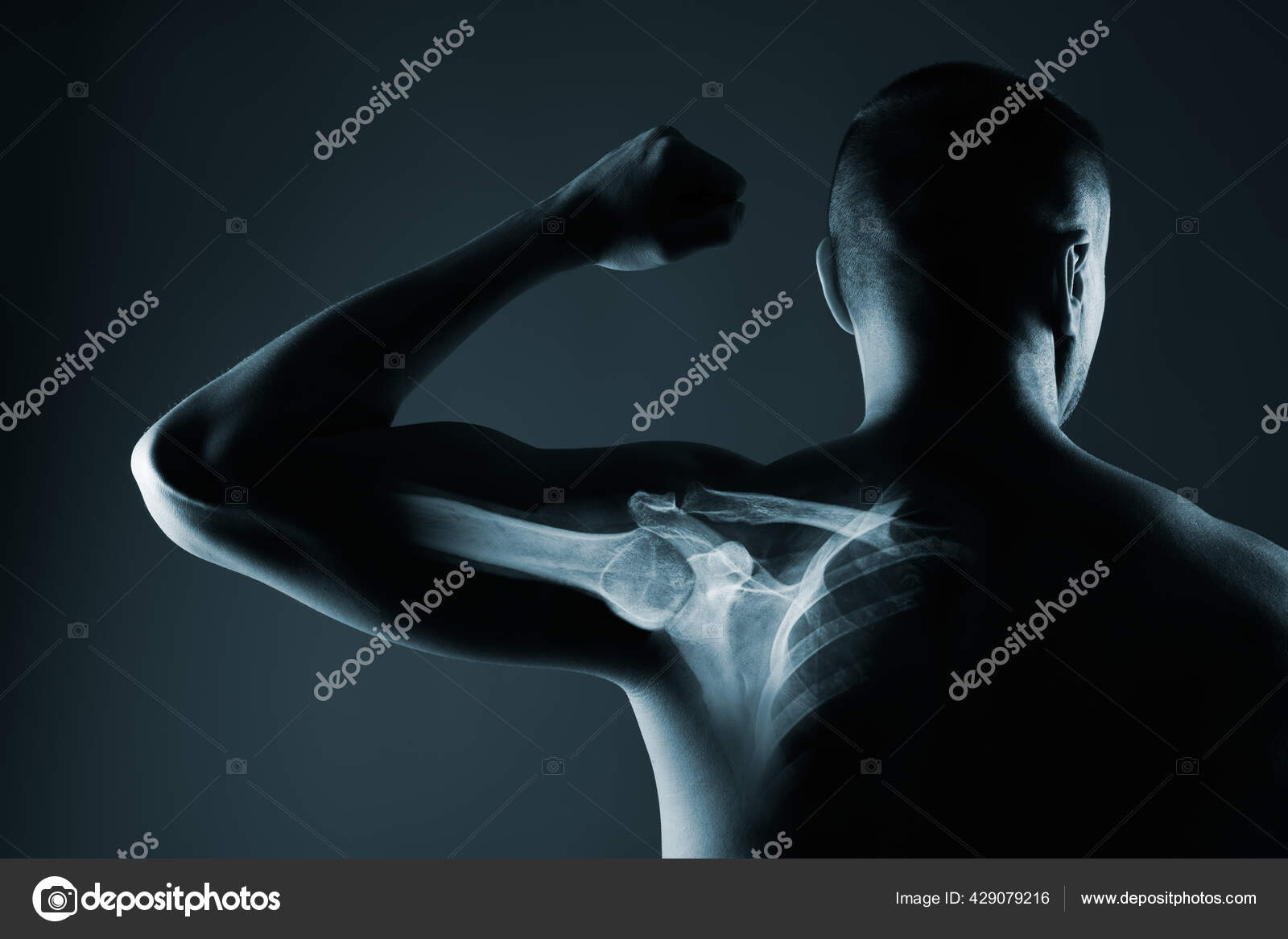 Human shoulder joint in x-ray on gray background Stock Photo by ...
