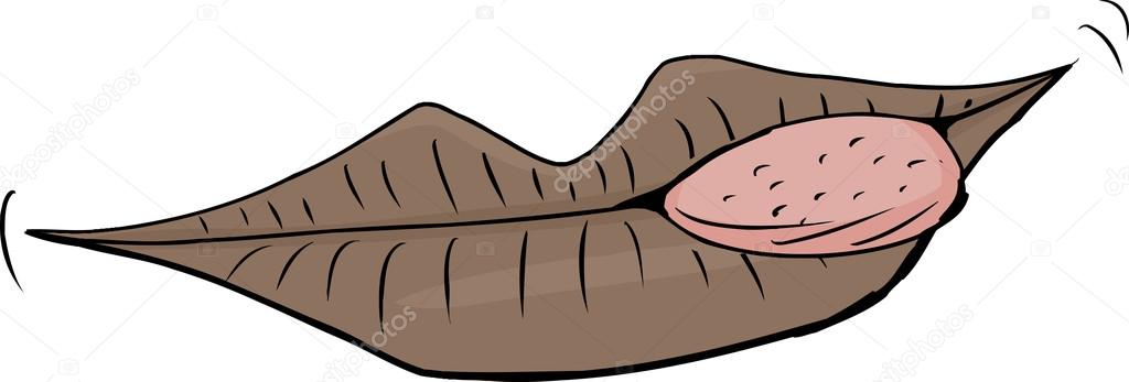 Chapped Lips Cartoon