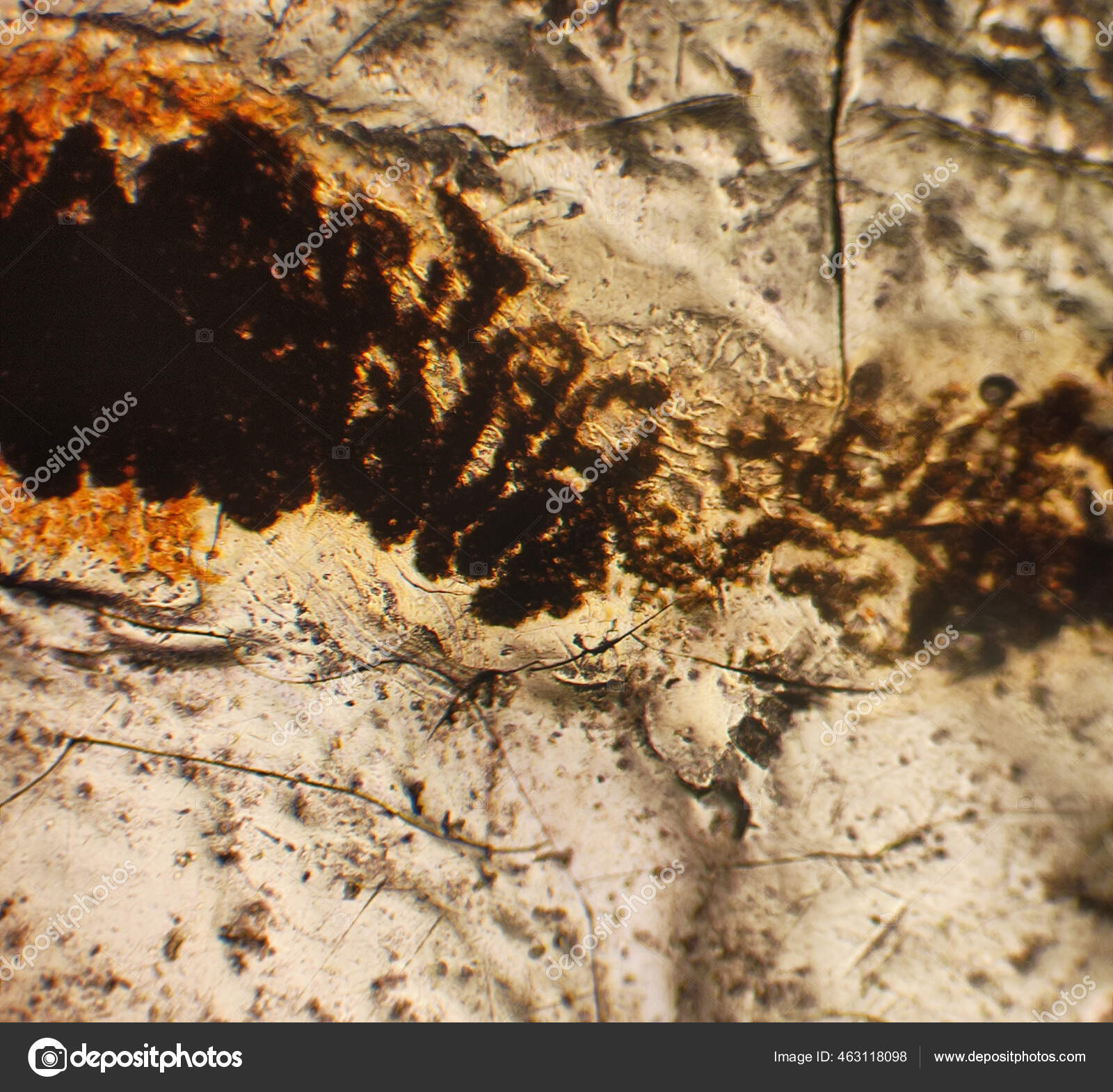Pinworms eggs Enterobius vermicularis in stool examination under ...