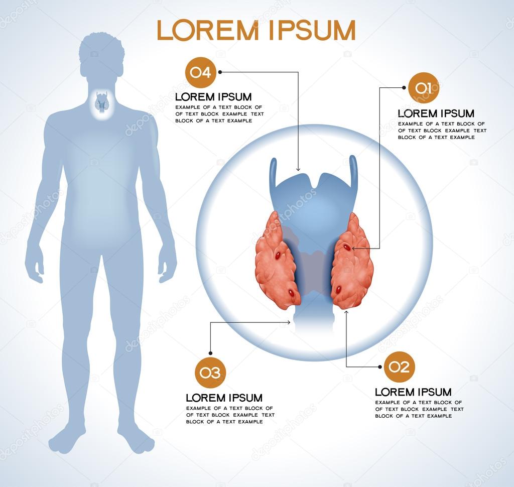 Parathryroid. Modern medical infographics. Stock Vector Image by ...