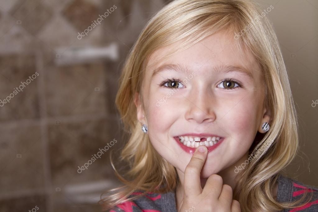 Child missing front tooth — Stock Photo © sjhuls #54067397