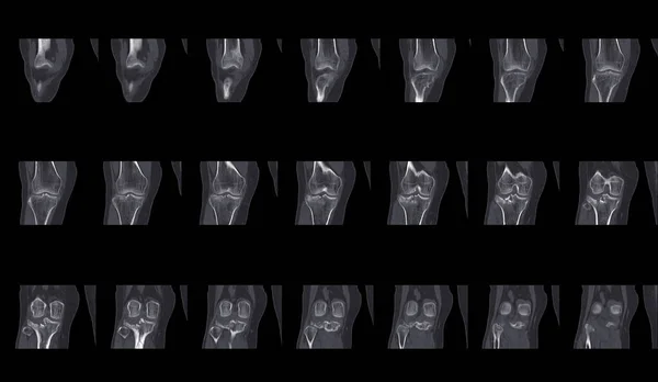 Plain x rays Stockfotos, lizenzfreie Plain x rays Bilder | Depositphotos