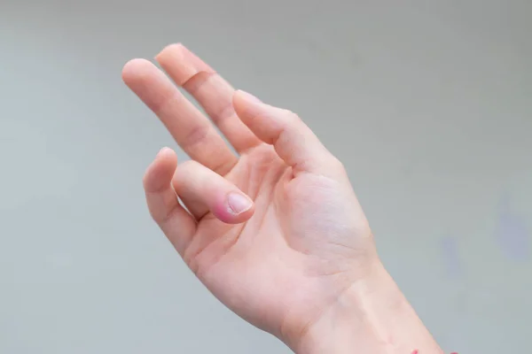 Abscess Finger Person Finger Infection Disease Fingernail Pain Copy ...