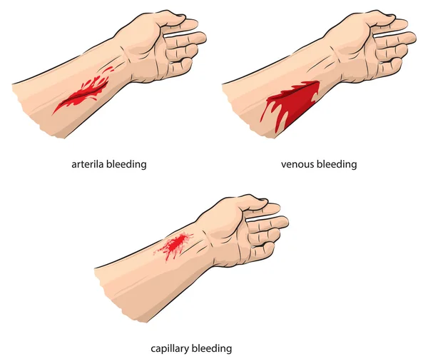 Bleeding Hands Images - Search Images on Everypixel