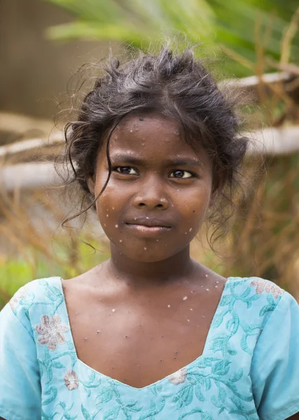 The face of chicken pox. - Stock Image - Everypixel