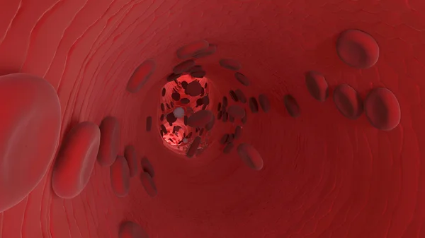 Blood particles Stock Photos, Royalty Free Blood particles Images ...