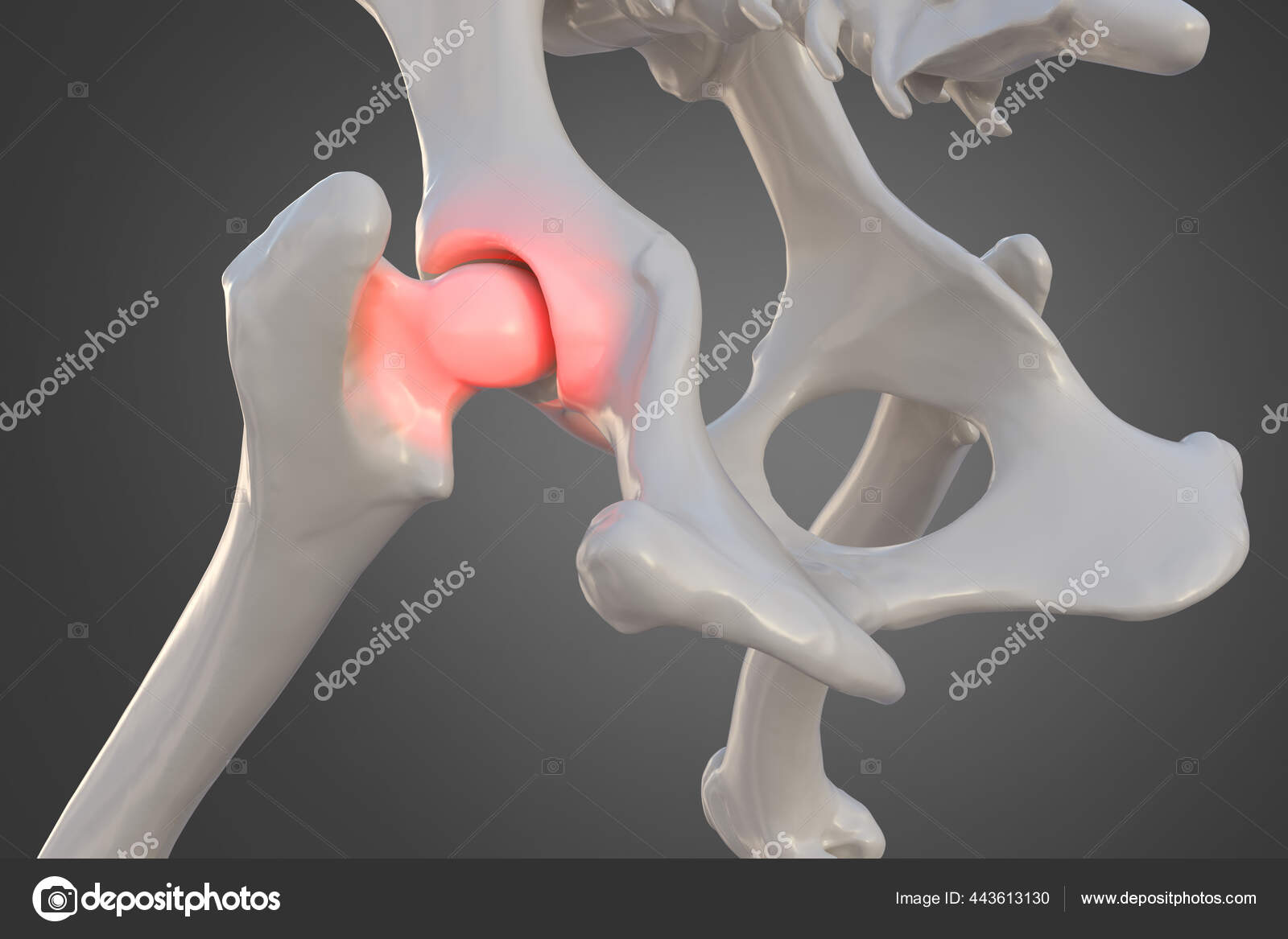 Fotos de Displasia Canina Hueso Perro Con Articulación Visible Cadera ...