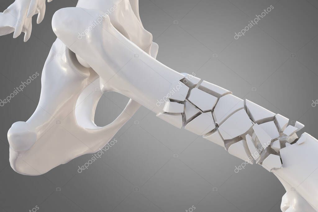 Hueso de fémur perro roto con otros huesos visibles. Esqueleto canino ...