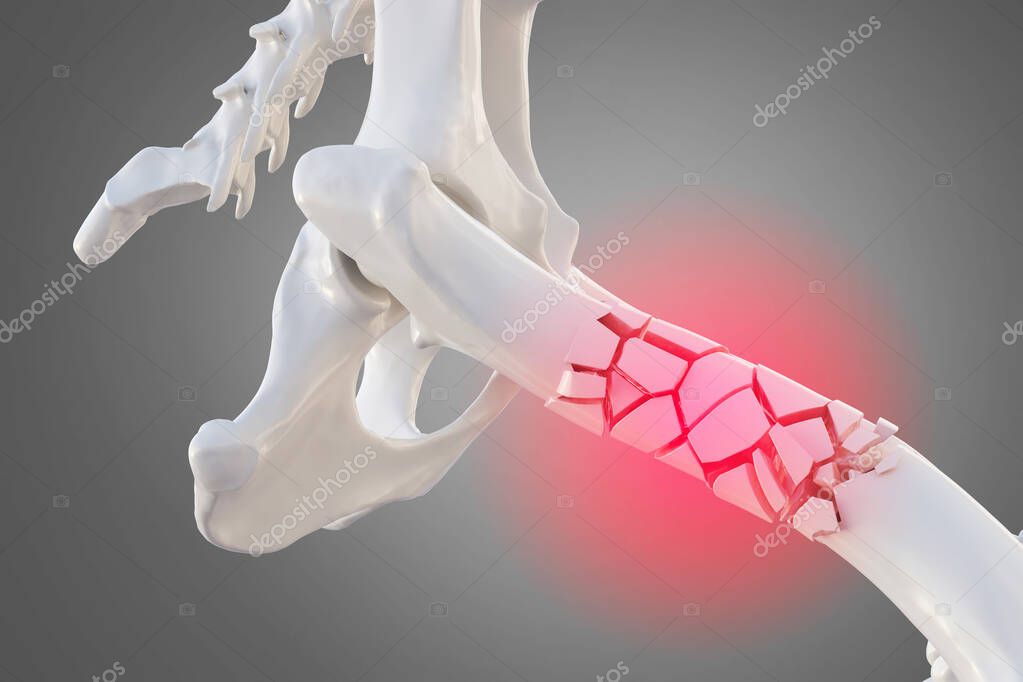 Hueso de fémur perro roto con otros huesos visibles. Esqueleto canino ...